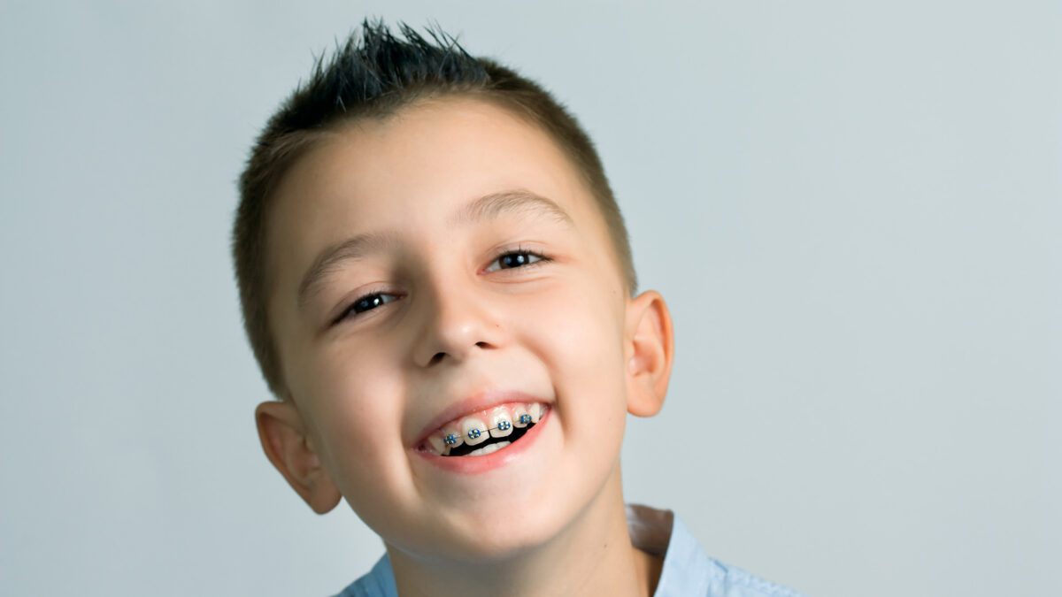 Phase 1 vs Phase 2 Orthodontics: Understanding the Difference